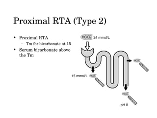 Non-anion gap Metabolic Acidosis (NAGMA) | PPT