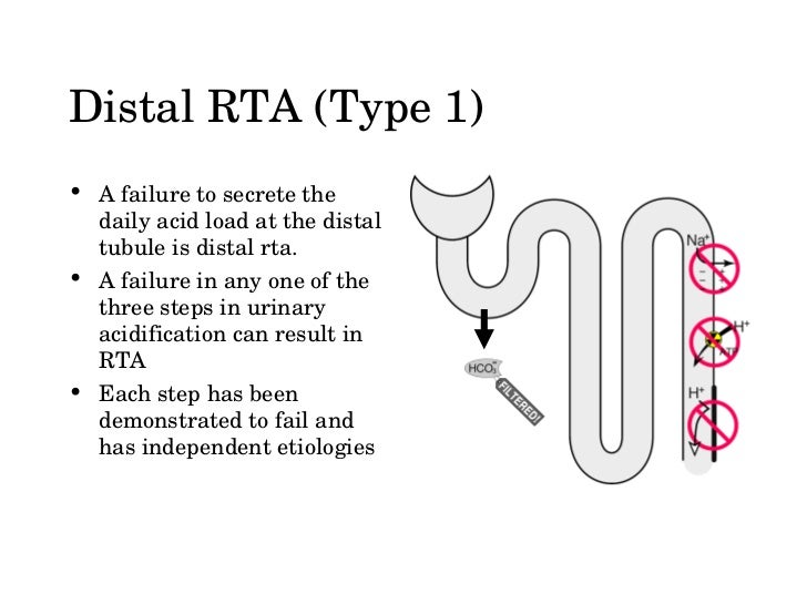 Non-anion gap Metabolic Acidosis (NAGMA)