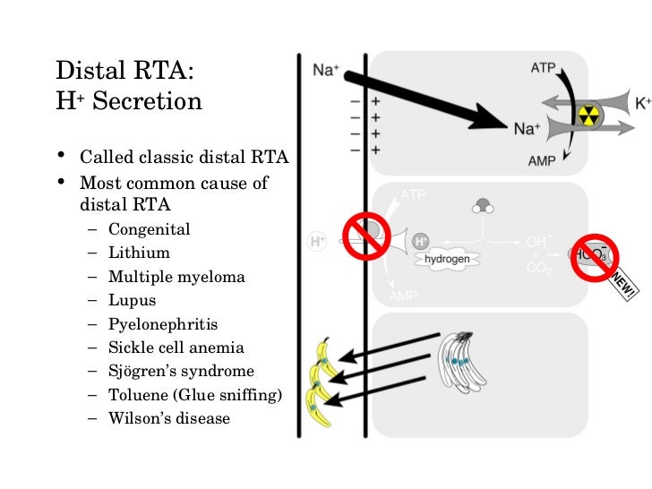 Non-anion gap Metabolic Acidosis (NAGMA)