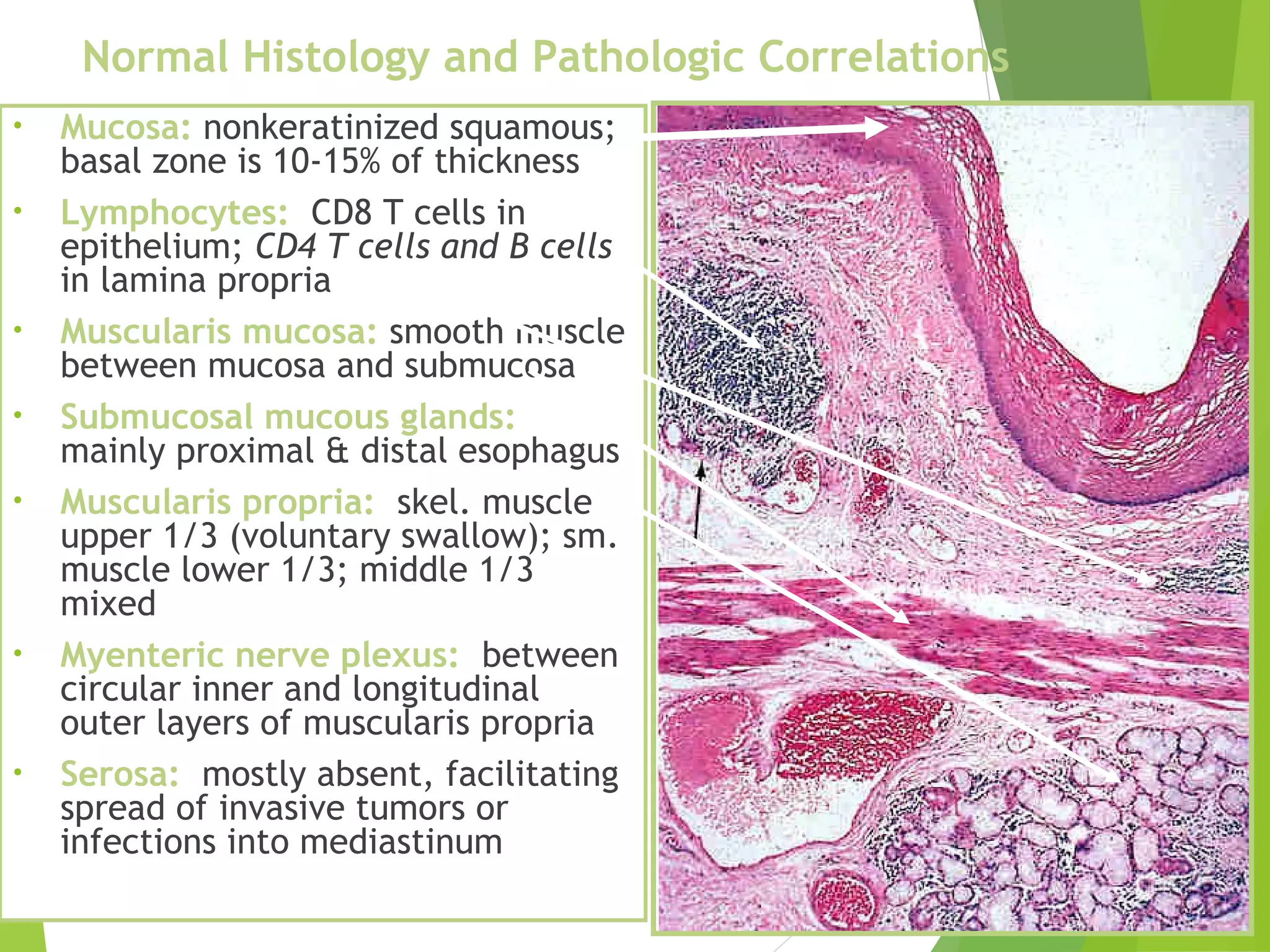 Pathology of the Esophagus | PPT