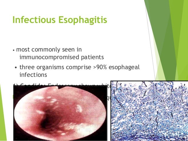 Pathology of the Esophagus