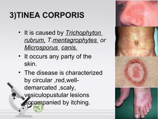 fungal diseases in humans and animals | PPT