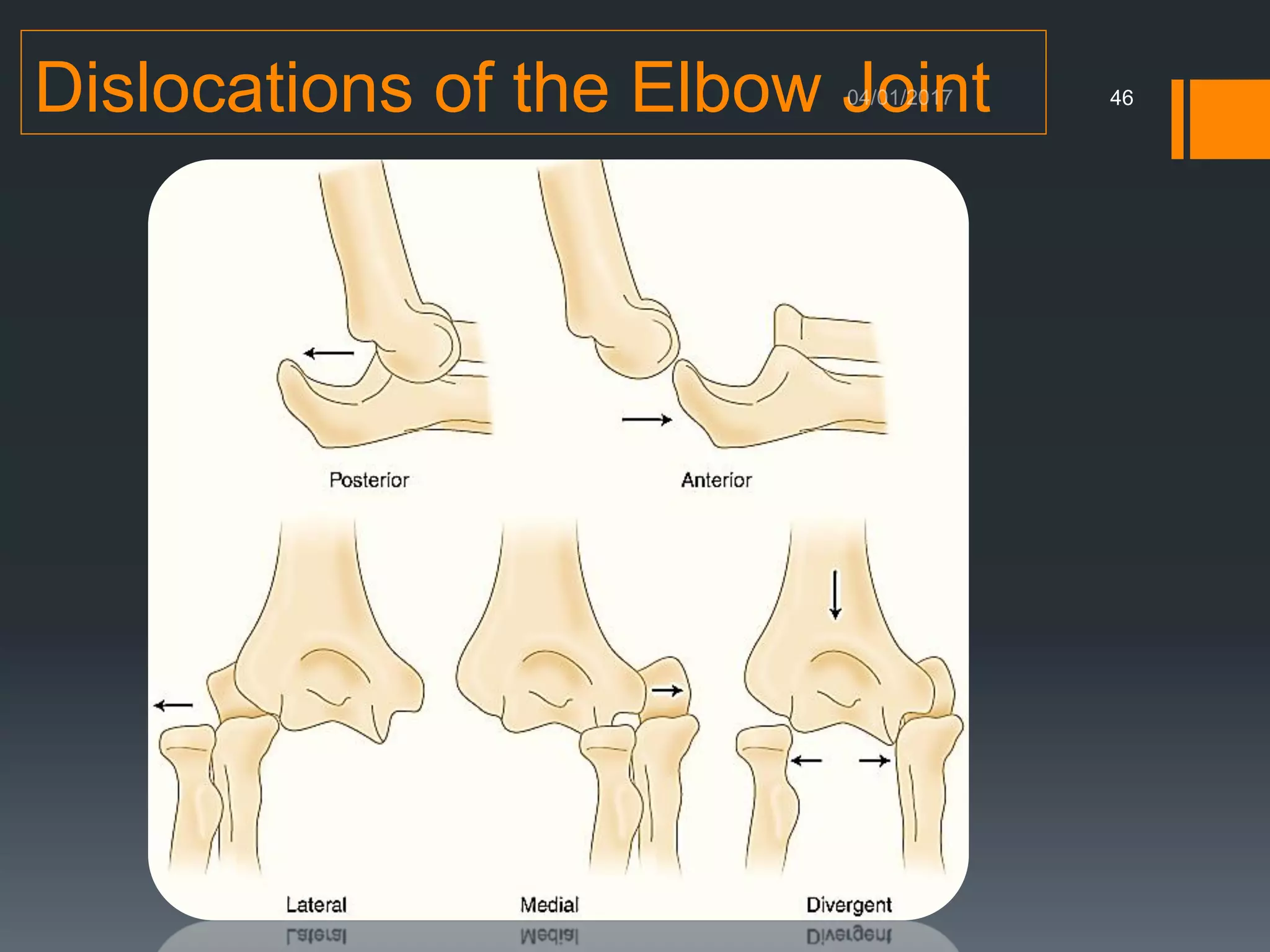 Nagwa el nefiawy elbow & radioulnar joints | PDF