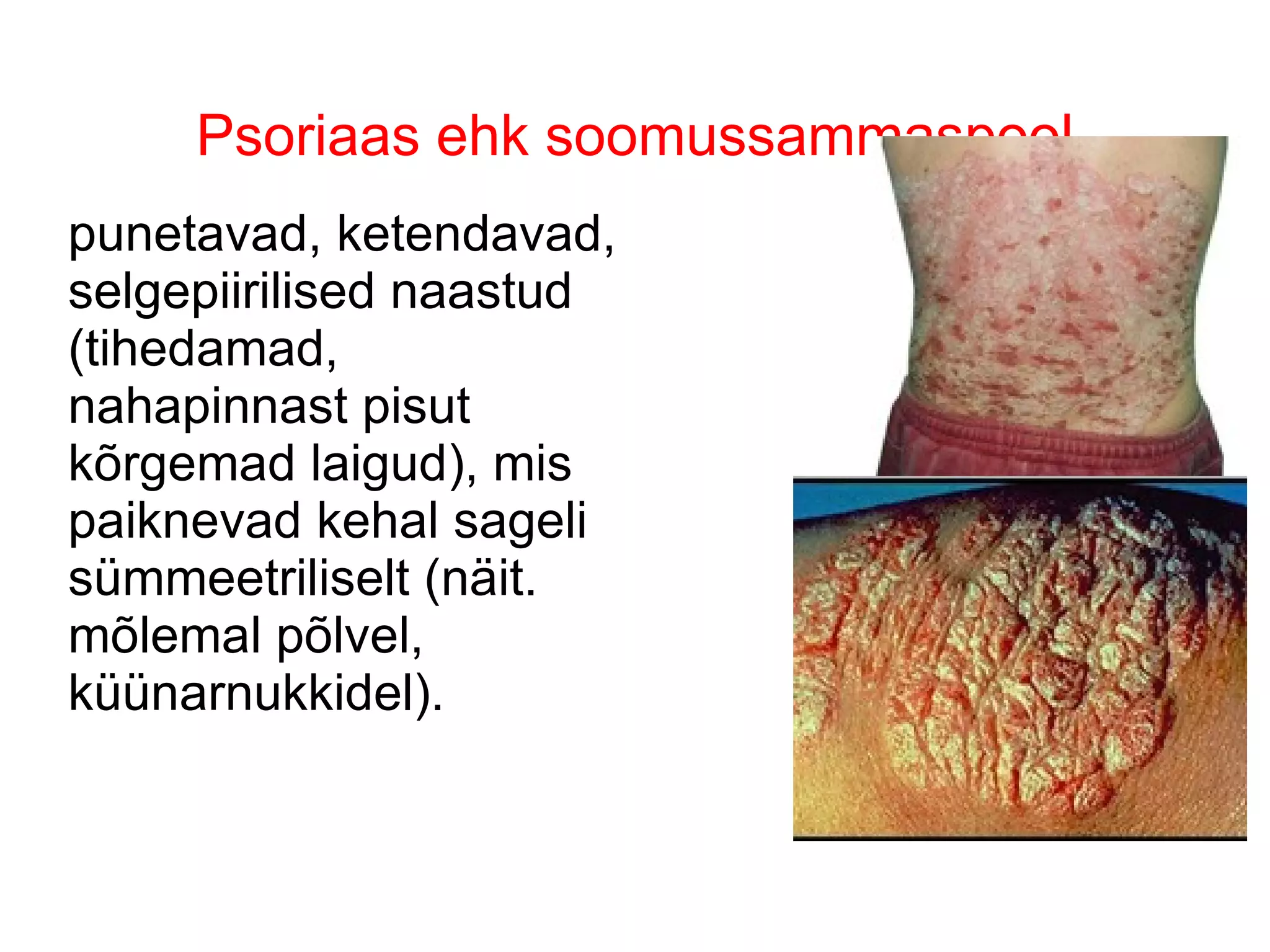 Nahahaigused | ODP