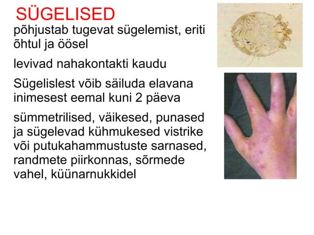 Nahahaigused | ODP