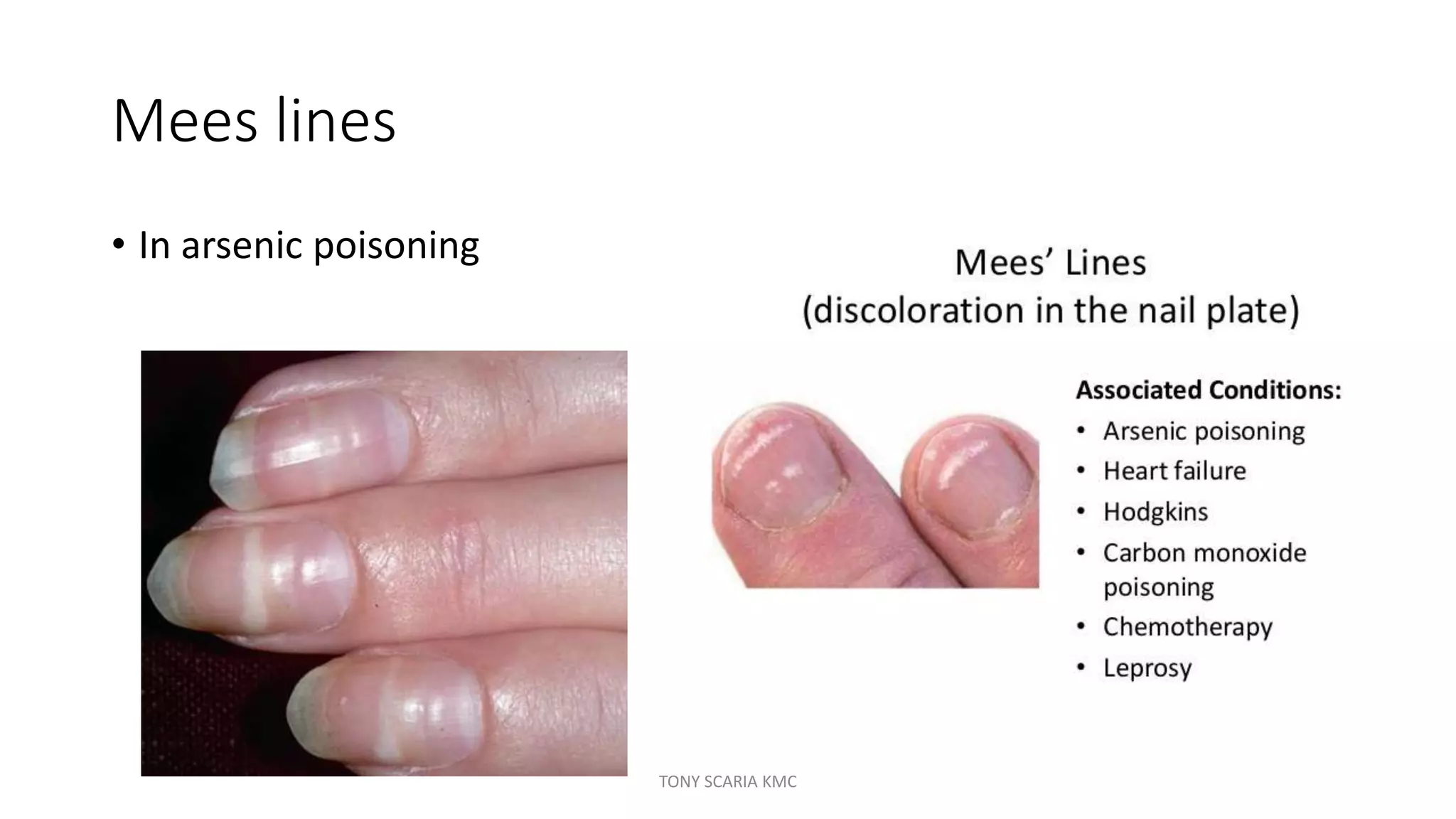 Nail DERMATOLOGY REVISION NOTES | PPTX