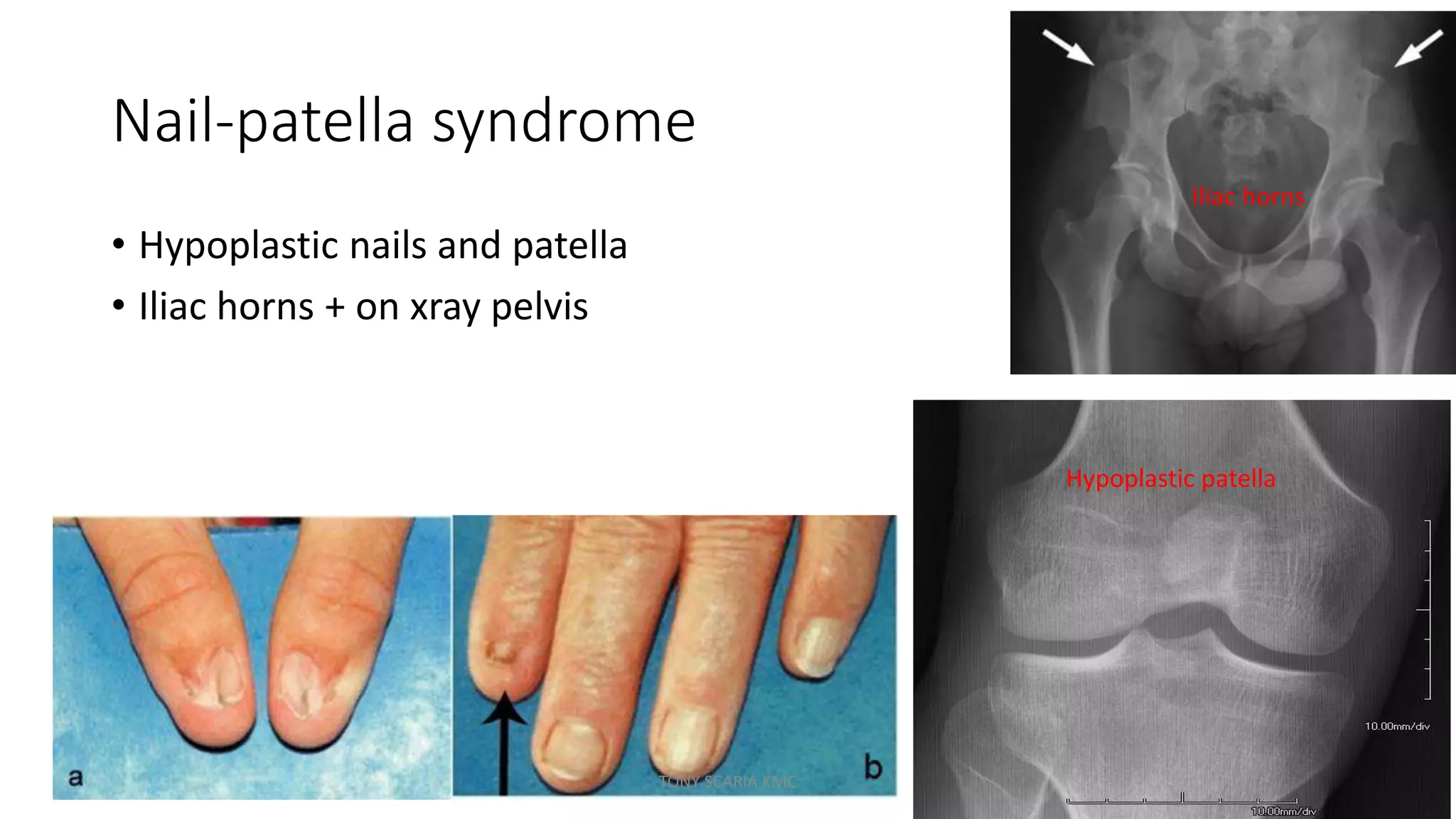 Nail DERMATOLOGY REVISION NOTES | PPTX