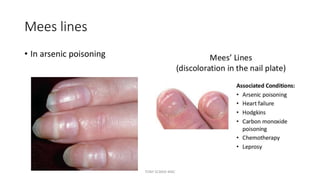 Nail DERMATOLOGY REVISION NOTES | PPTX