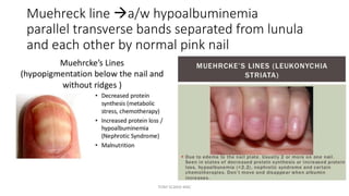 Nail DERMATOLOGY REVISION NOTES | PPTX