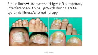 Nail DERMATOLOGY REVISION NOTES | PPTX
