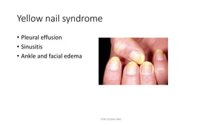 Nail DERMATOLOGY REVISION NOTES | PPTX