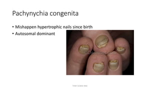 Nail DERMATOLOGY REVISION NOTES | PPTX