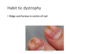 Nail DERMATOLOGY REVISION NOTES | PPTX