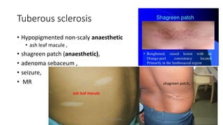 Nail DERMATOLOGY REVISION NOTES | PPTX