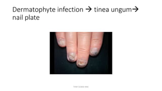 Nail DERMATOLOGY REVISION NOTES | PPTX