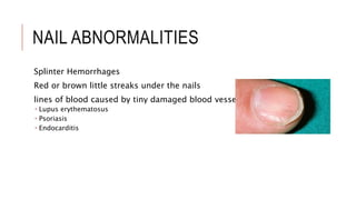 Nail Abnormalities | PPT