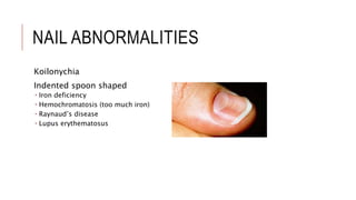 Nail Abnormalities | PPT