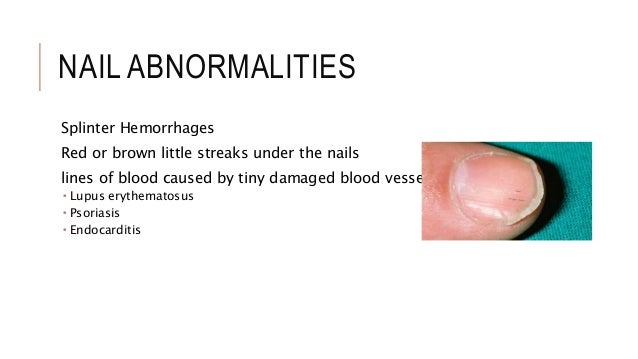 Nail Abnormalities