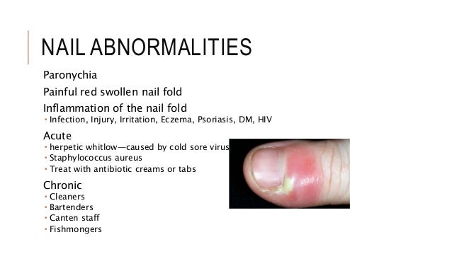 Nail Abnormalities
