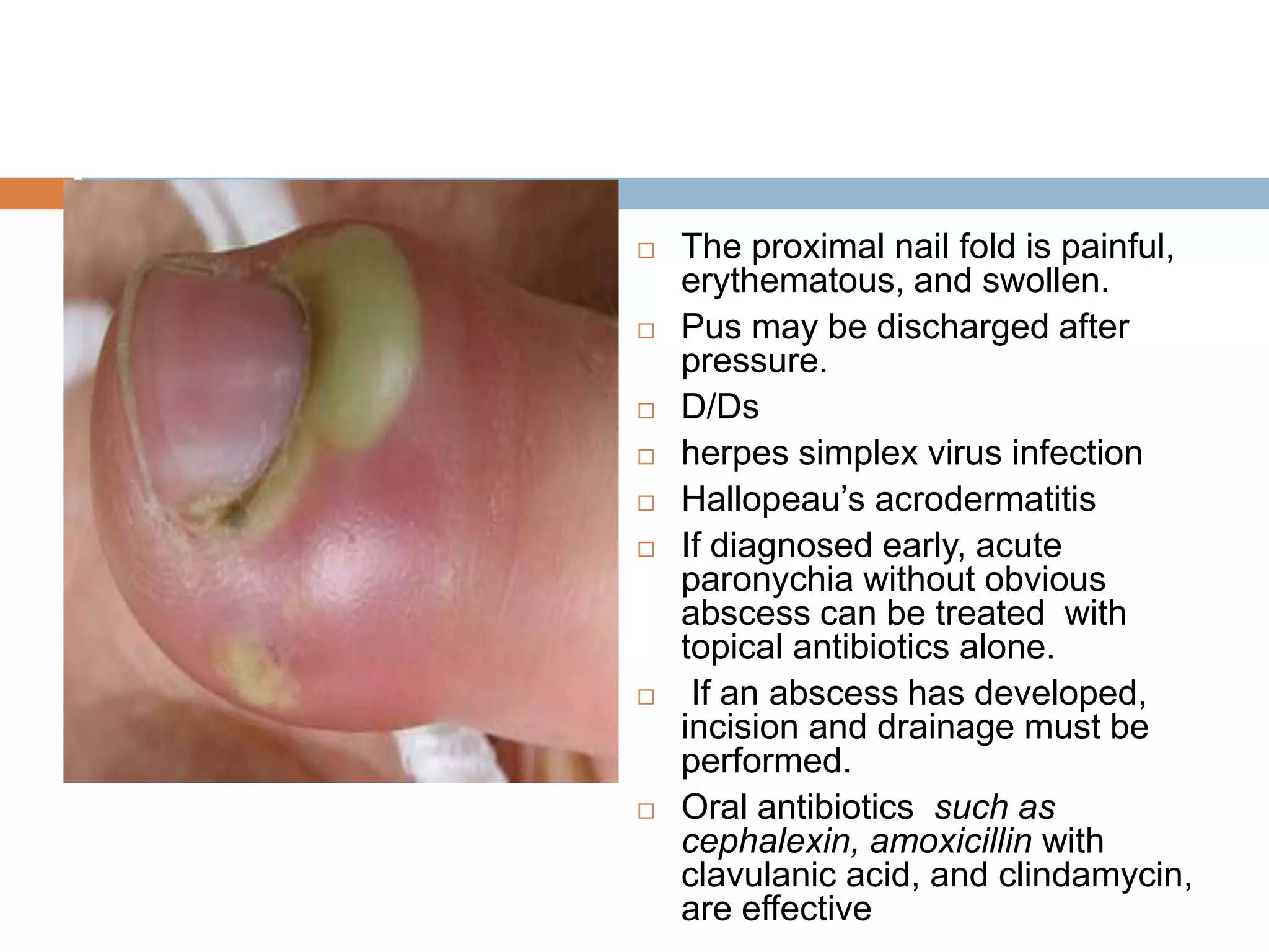 Nail anatomy and its disorders | PPTX