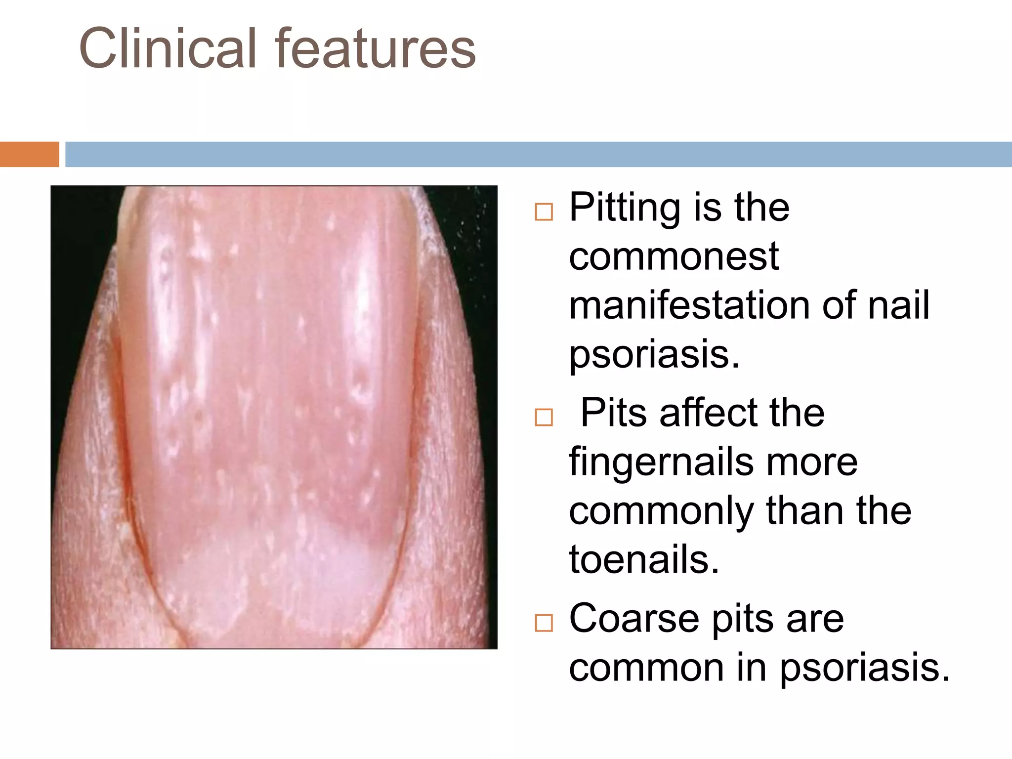 Nail anatomy and its disorders | PPTX