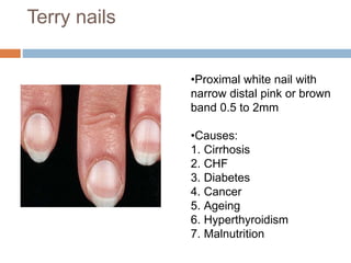 Nail anatomy and its disorders | PPTX