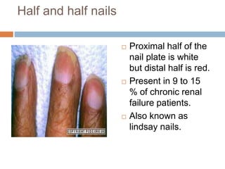 Nail anatomy and its disorders | PPTX