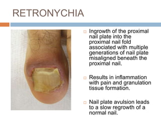 Nail anatomy and its disorders | PPTX
