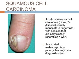 Nail anatomy and its disorders | PPTX
