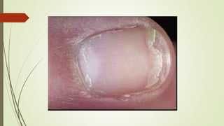 Nail and its Structure.pptx