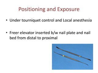 Nail bed injury | PPTX
