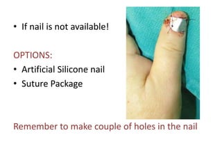 Nail bed injury | PPT