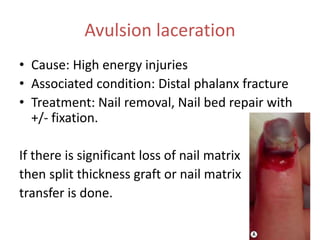 Nail bed injury | PPT