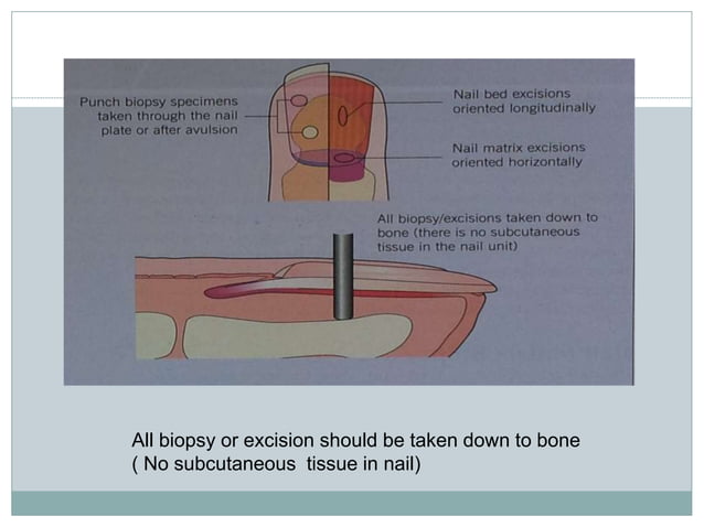 Nail biopsy | PPTX | Nail Care | Beauty