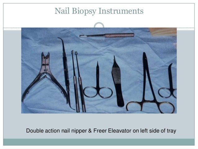 Nail biopsy
