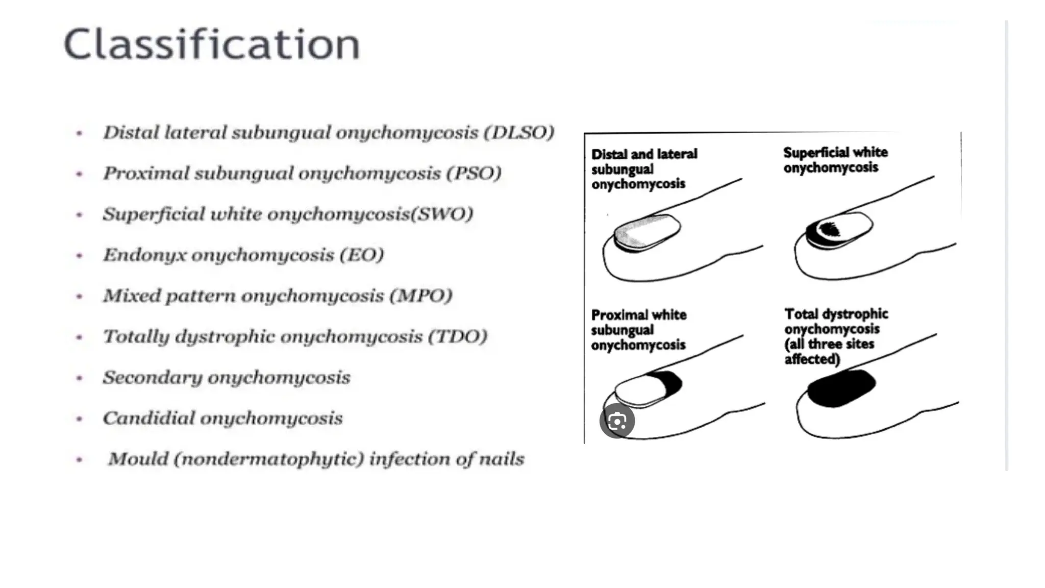 Nail changes in dermatology.pptx about common patterns | PPTX