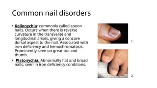 Nail changes in dermatology.pptx about common patterns | PPTX