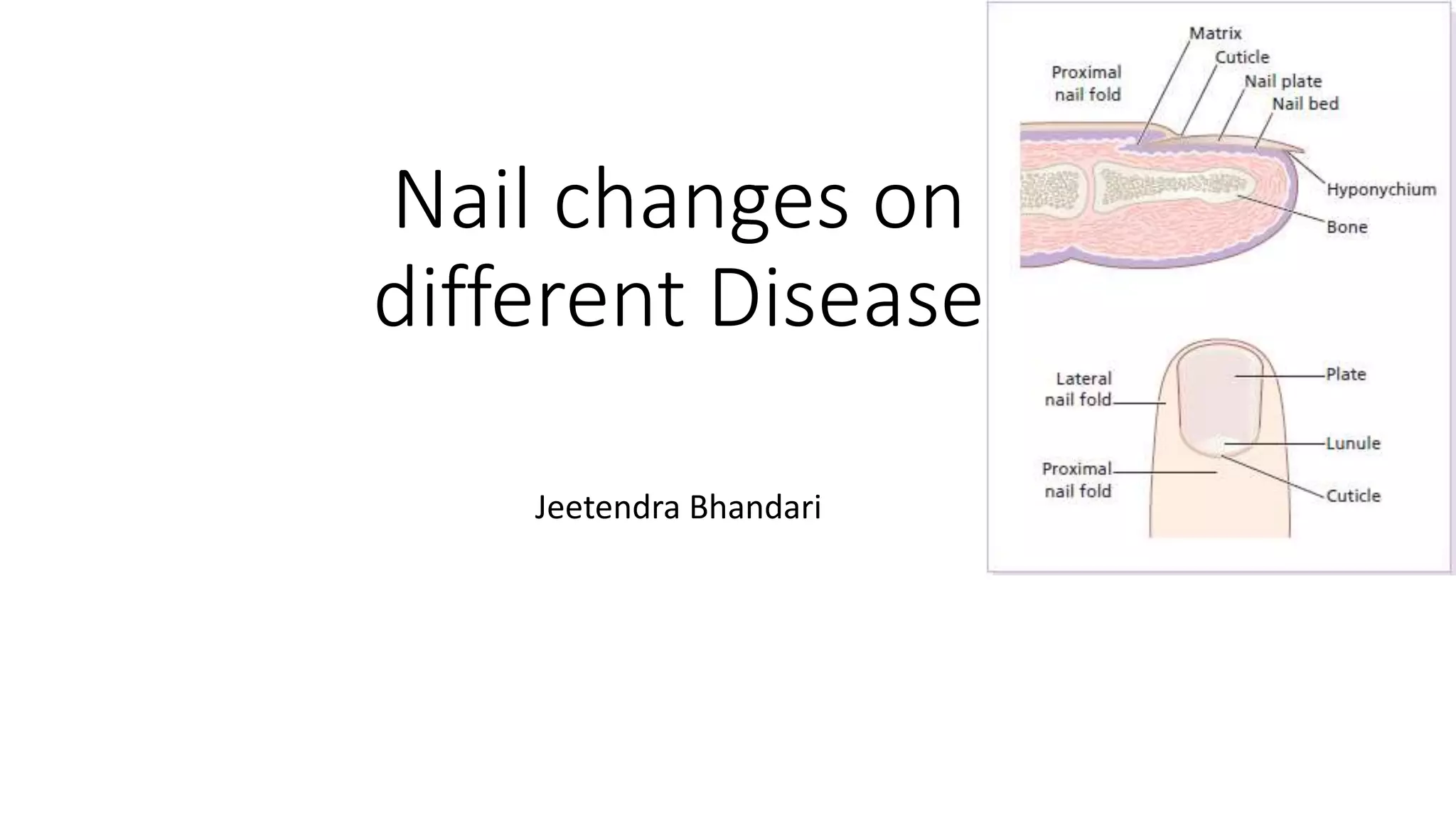 Nail changes on different dermatologic disease | PPT
