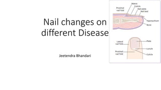 Nail changes on different dermatologic disease | PPT
