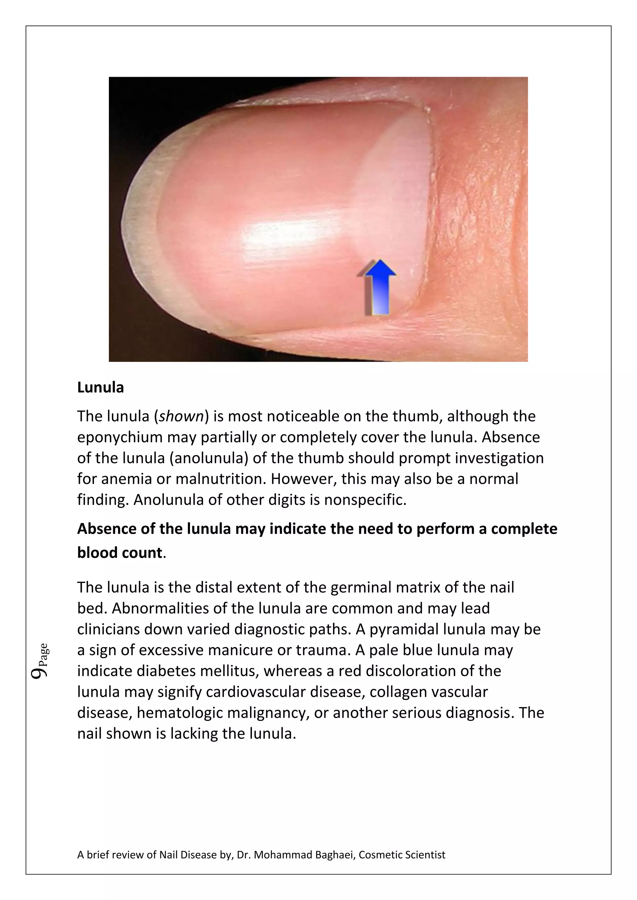 a brief review of nail diseases by, Dr. Mohammad Baghaei | PDF