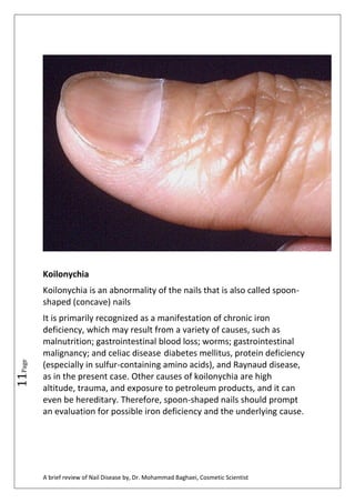 a brief review of nail diseases by, Dr. Mohammad Baghaei | PDF
