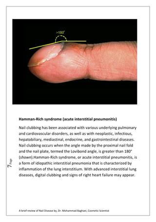 a brief review of nail diseases by, Dr. Mohammad Baghaei | PDF