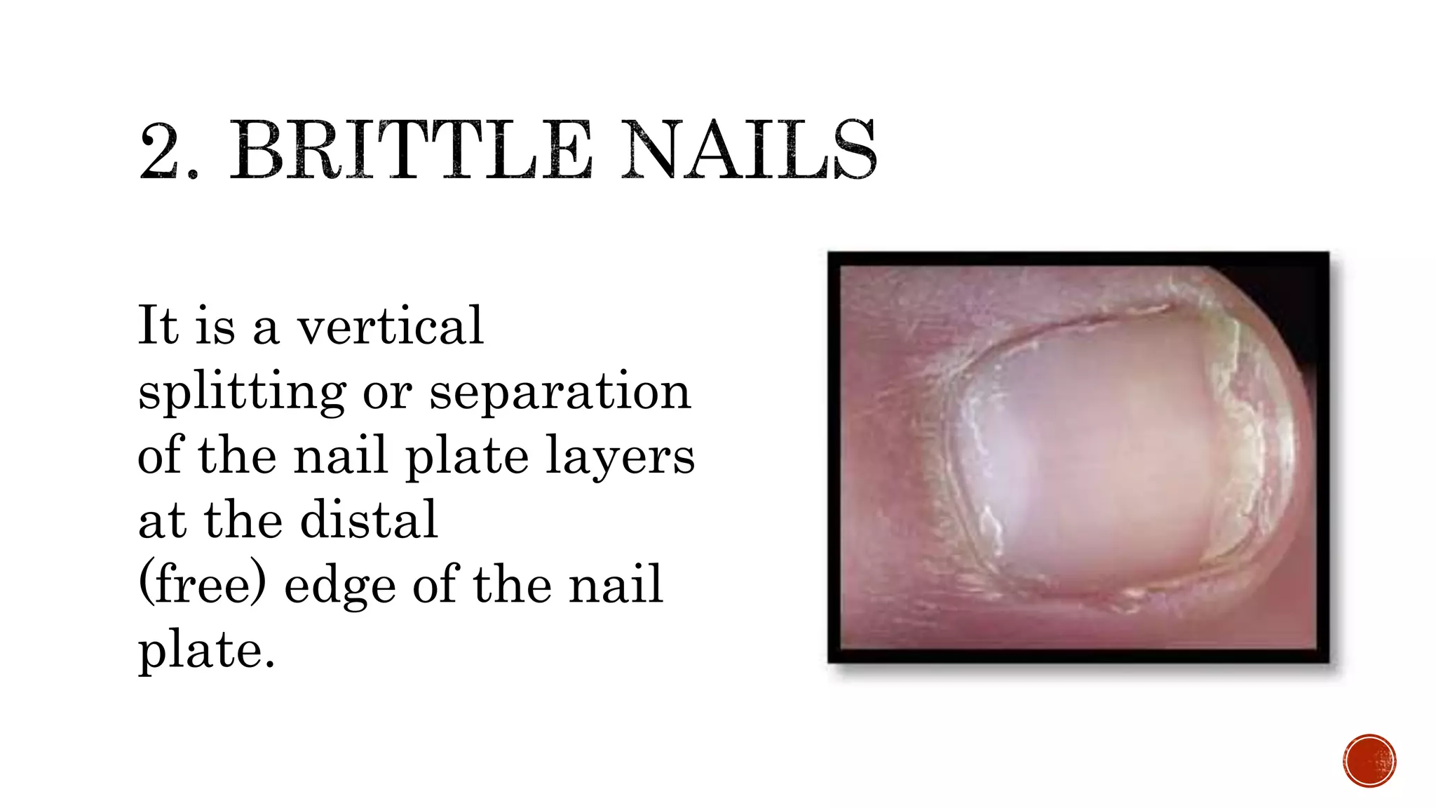 Nail Diseases.pptx