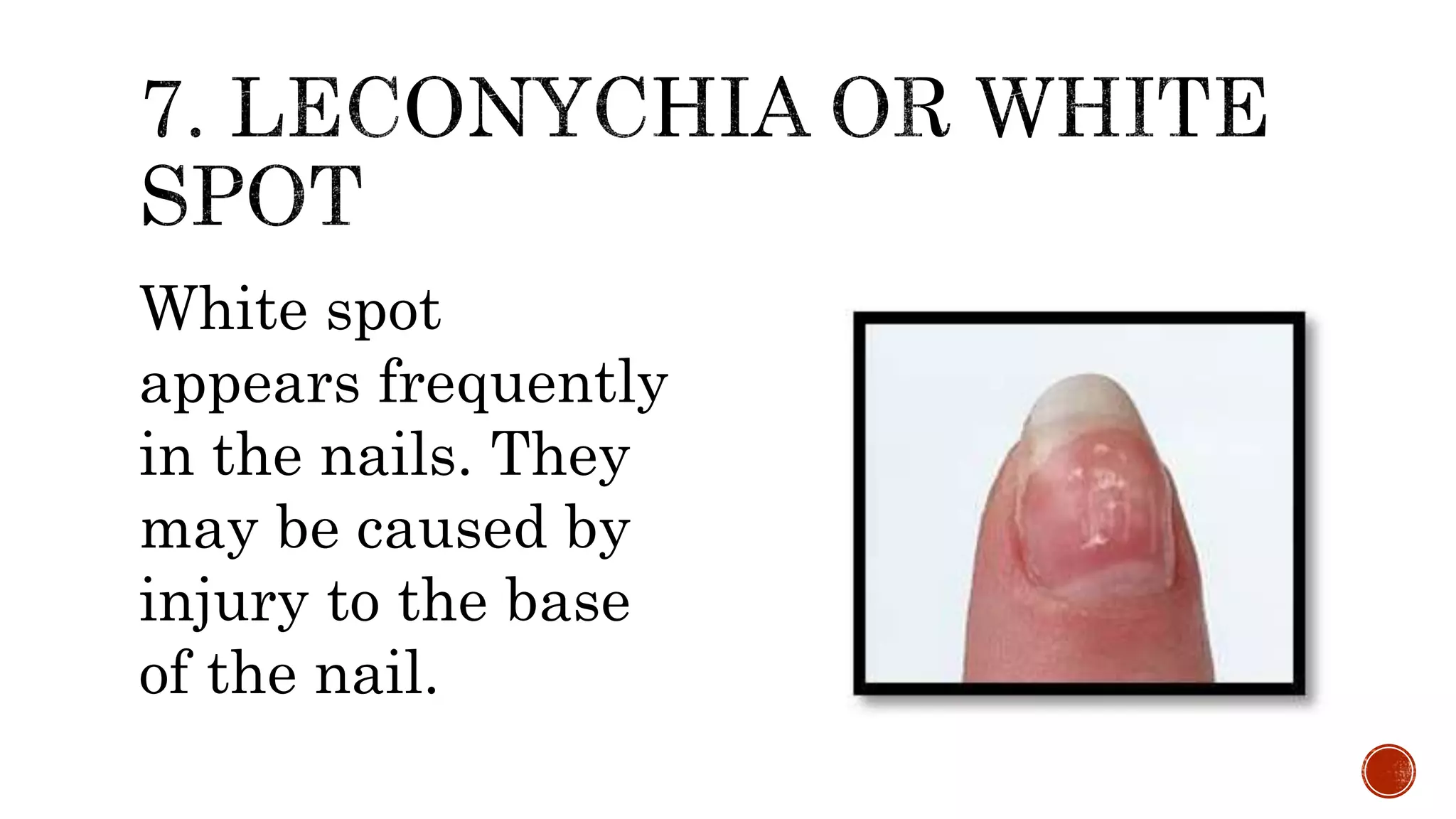 Nail Diseases.pptx