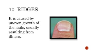 Nail Diseases.pptx