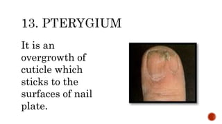 Nail Diseases.pptx