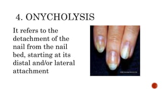 Nail Diseases.pptx