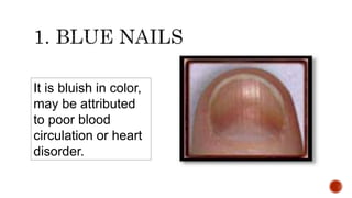 Nail Diseases.pptx