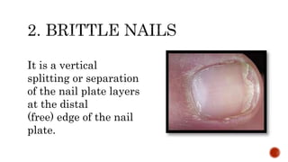 Nail Diseases.pptx