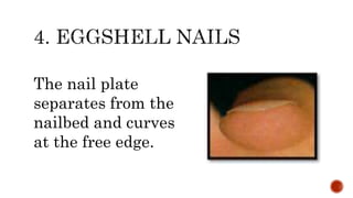 Nail Diseases.pptx